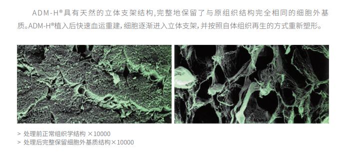 从花蕾到荼蘼，ADM-H全方位守护女性的每一个花期-春雨医生